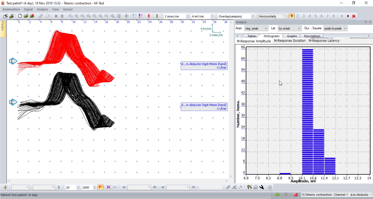 Electroneuromyography M-TEST ONE 8-channel. DX-systems.